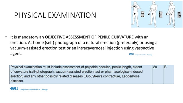 Peyronies disease: diagnostic | PPTX
