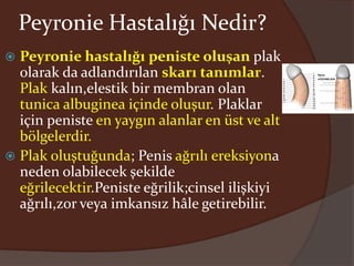Peyroni Hastalığı | PPTX