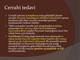 Peyroni Hastalığı | PPTX