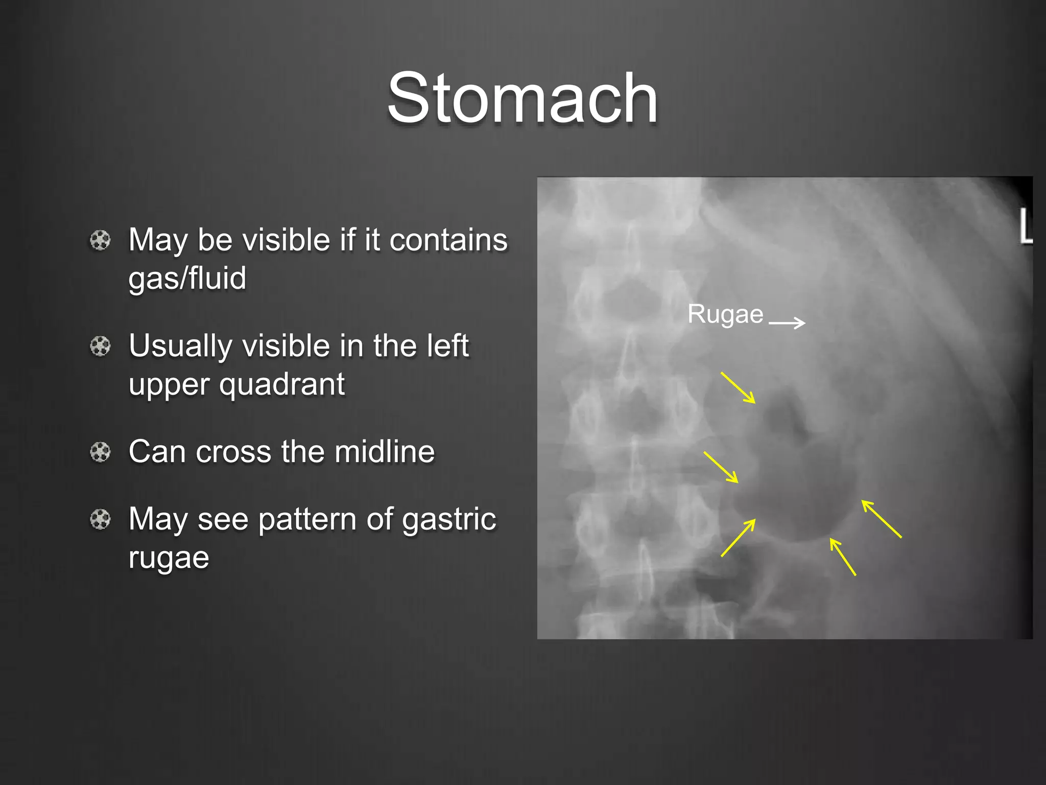 Approach to PFA Interpretation | PPTX