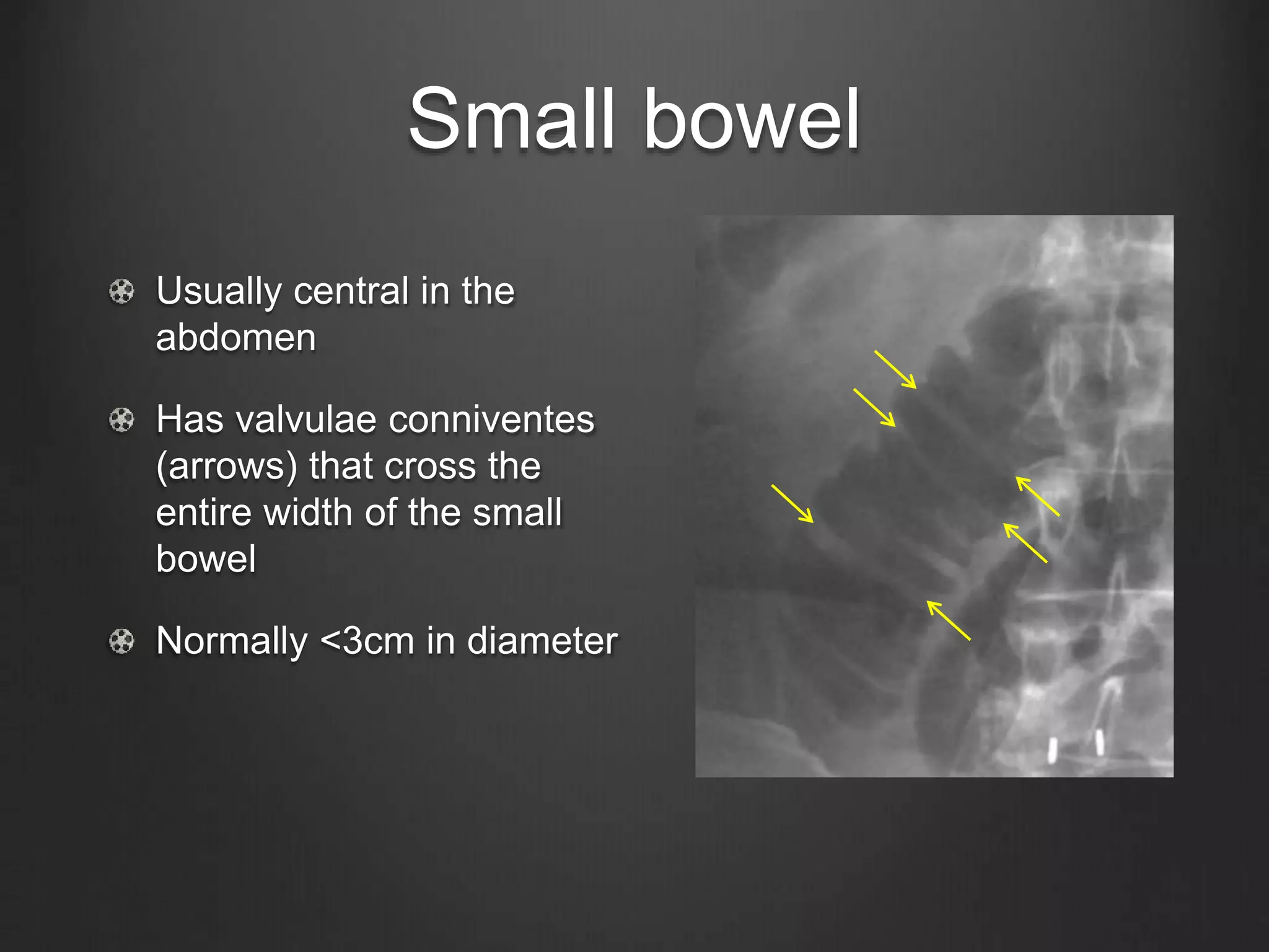 Approach to PFA Interpretation | PPTX