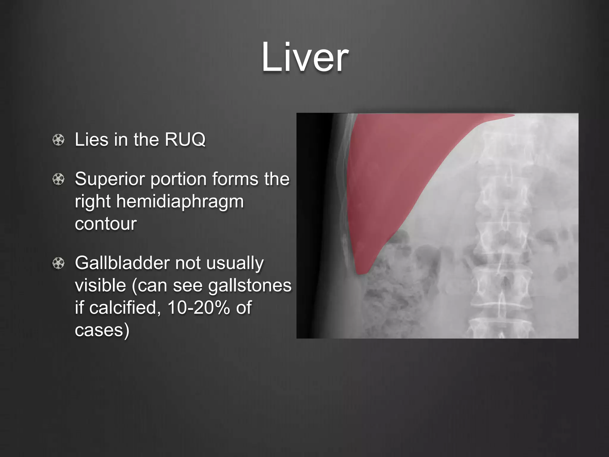 Approach to PFA Interpretation | PPTX