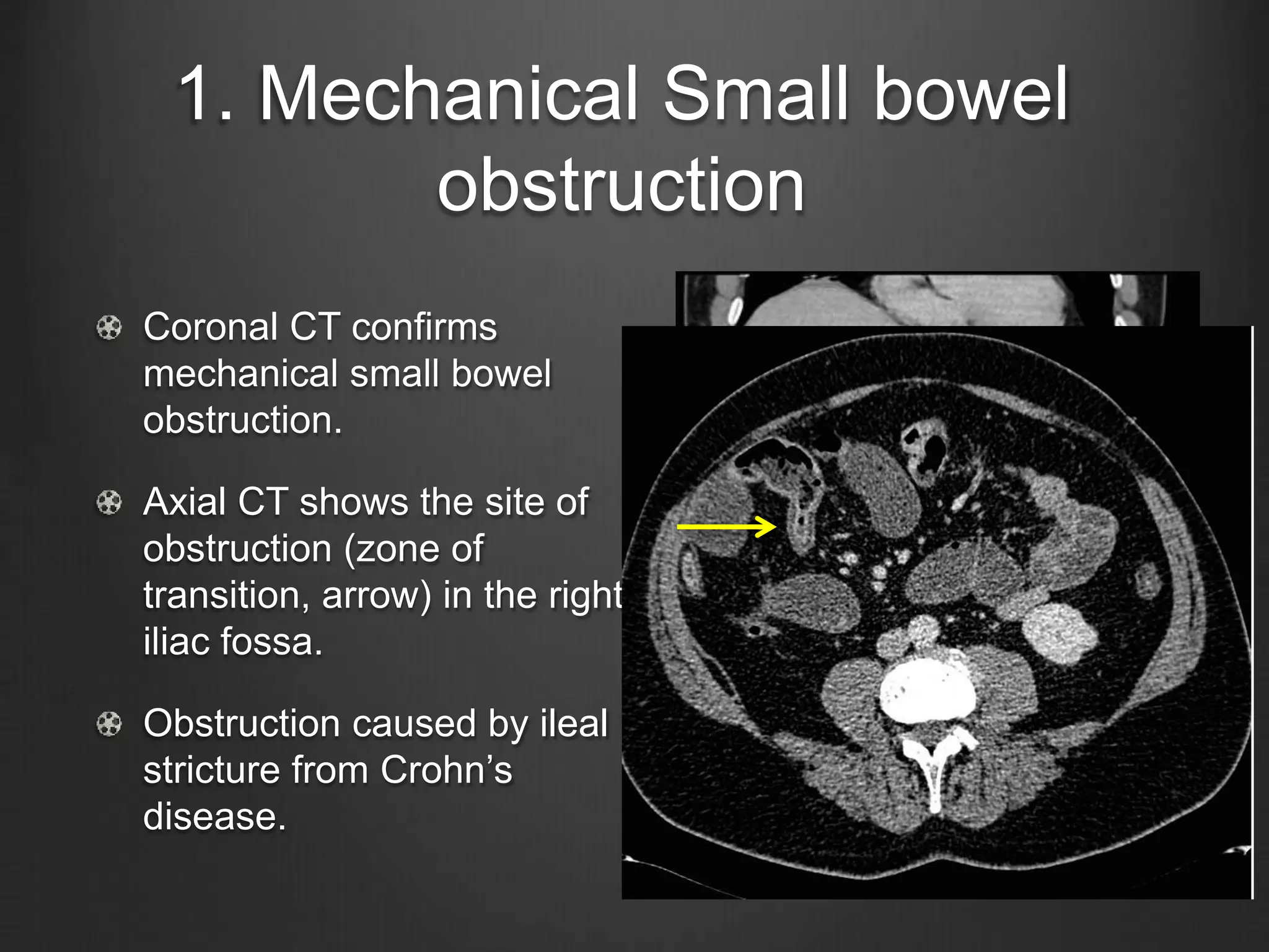 Approach to PFA Interpretation | PPTX