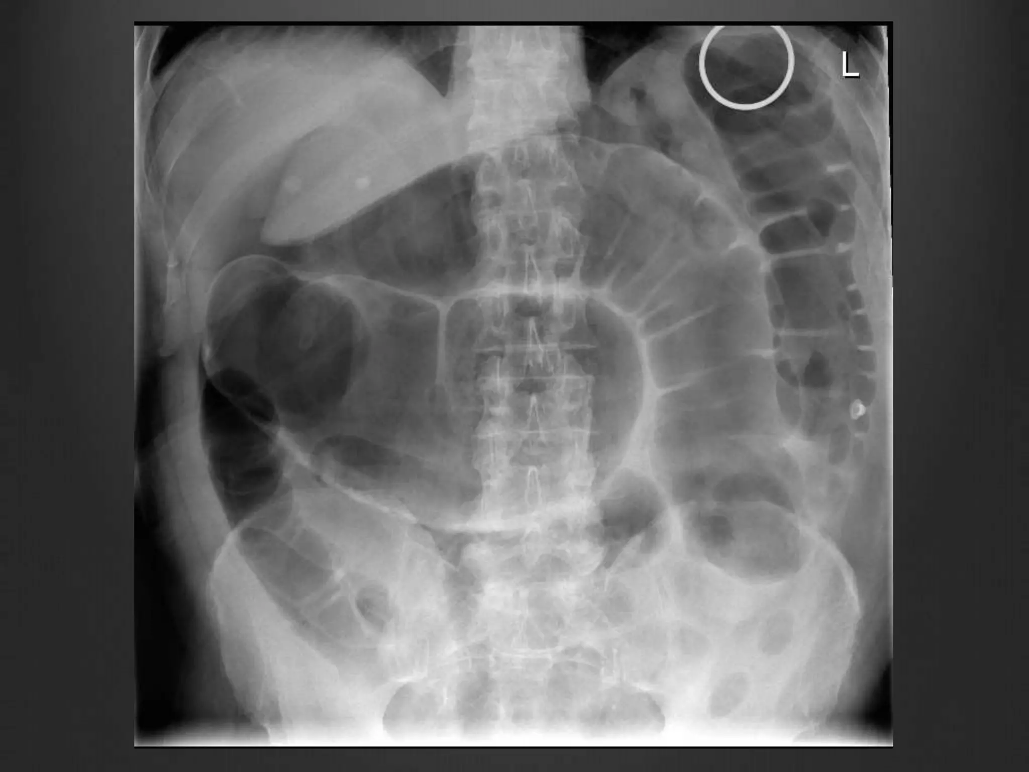 Approach to PFA Interpretation | PPTX