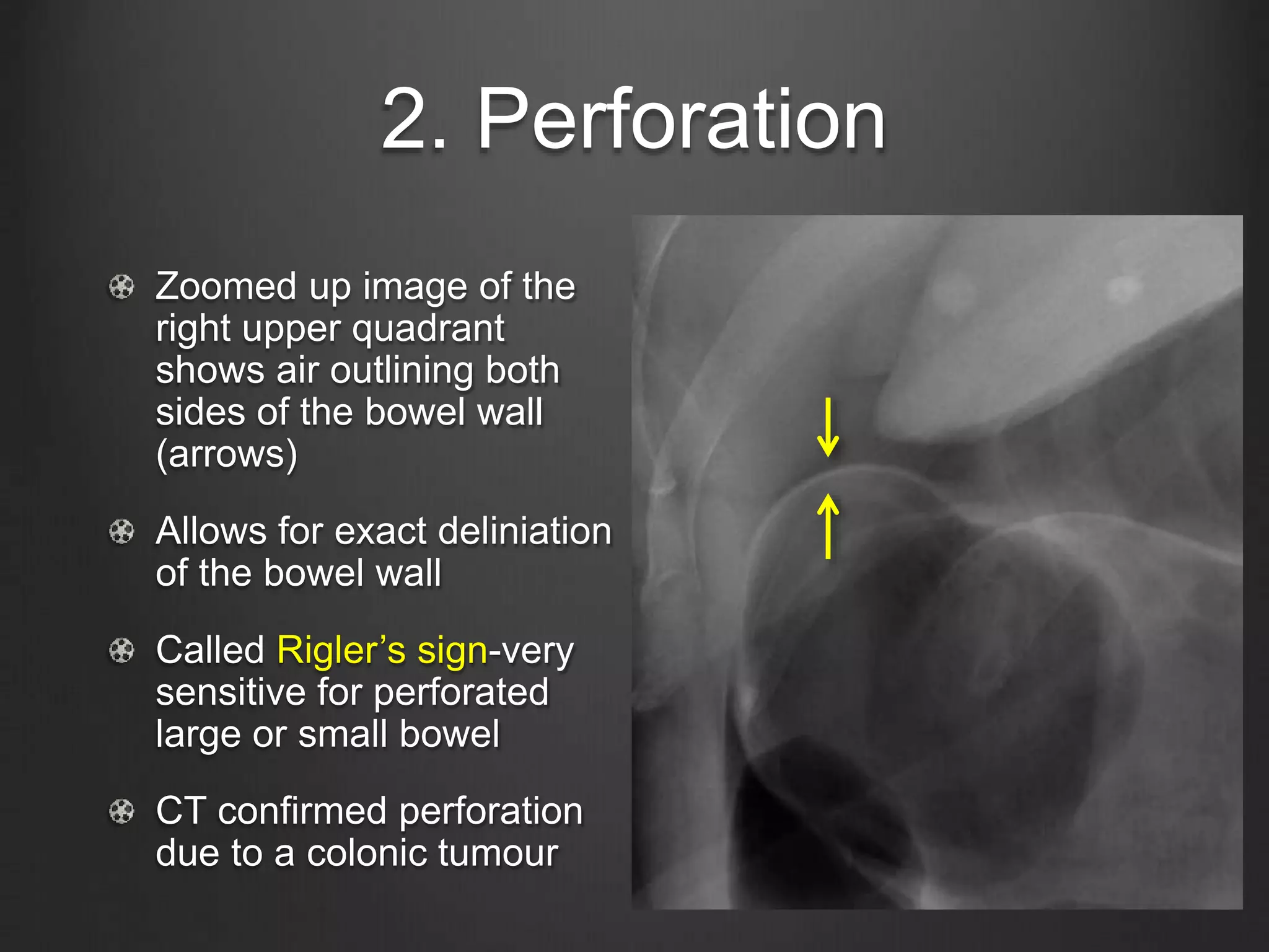 Approach to PFA Interpretation | PPTX