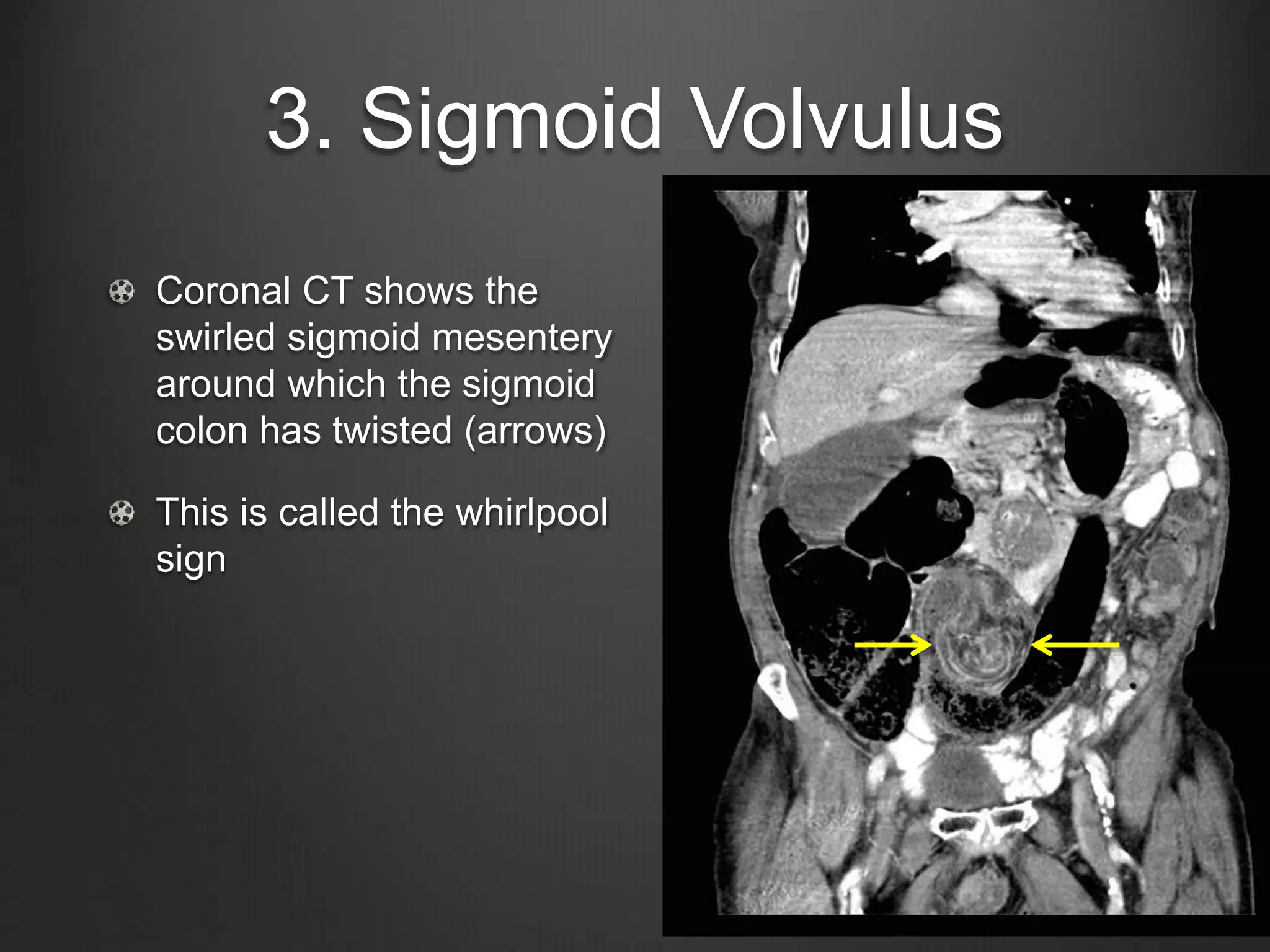 Approach to PFA Interpretation | PPTX