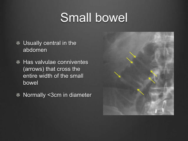 Approach to PFA Interpretation | PPTX | Digestive Disorders | Diseases ...