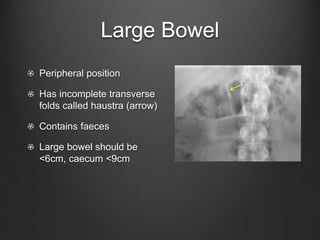 Approach to PFA Interpretation | PPTX