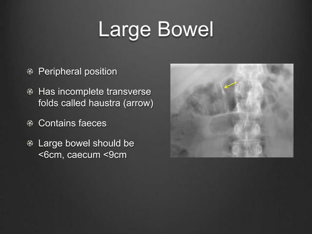 Approach to PFA Interpretation | PPTX | Digestive Disorders | Diseases and Conditions