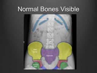 Approach to PFA Interpretation | PPTX