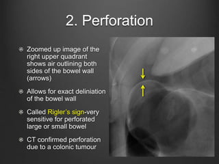 Approach to PFA Interpretation | PPTX