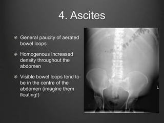 Approach to PFA Interpretation | PPTX
