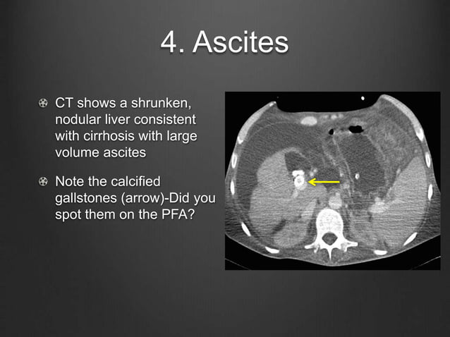 Approach to PFA Interpretation | PPTX | Digestive Disorders | Diseases and Conditions