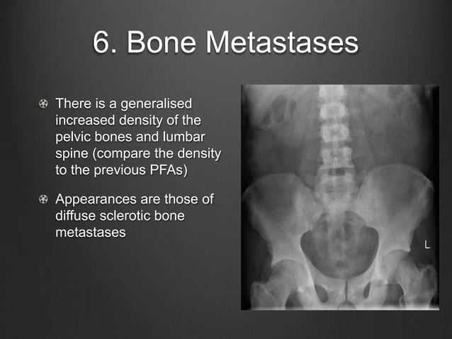 Approach to PFA Interpretation | PPTX | Digestive Disorders | Diseases and Conditions