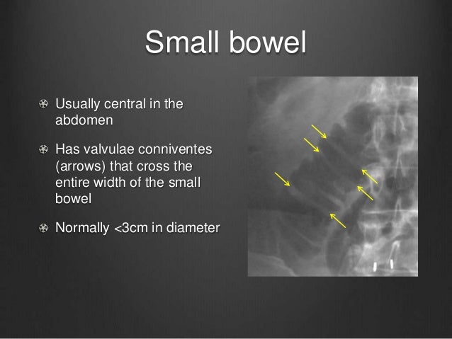 Approach to PFA Interpretation