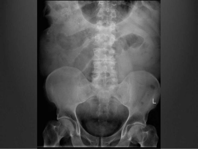Approach to PFA Interpretation