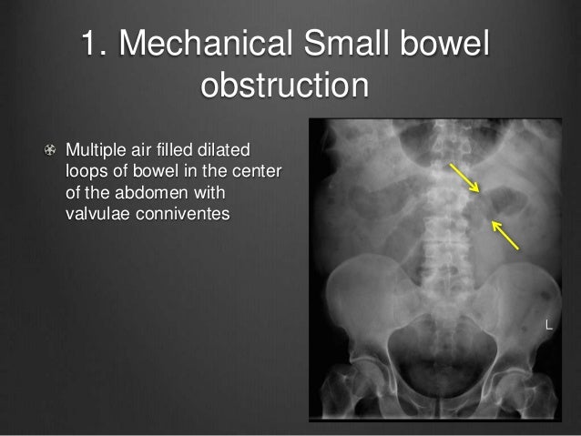Approach to PFA Interpretation