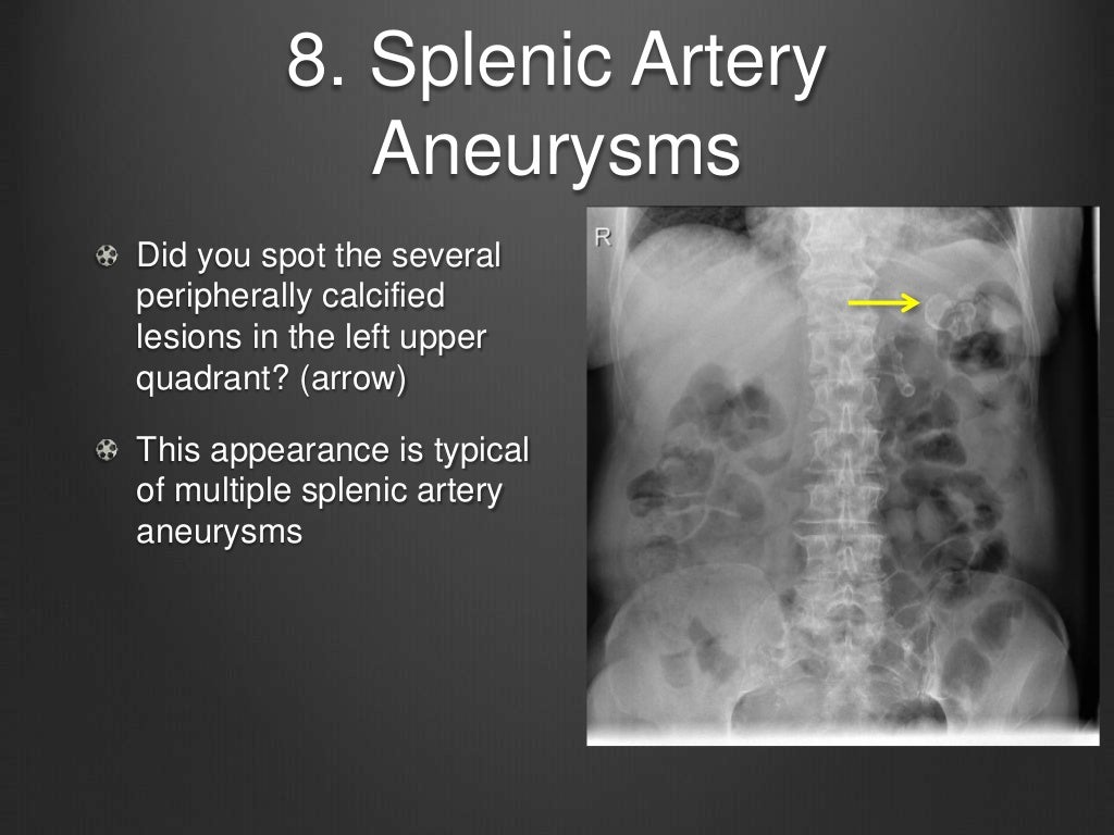 Approach to PFA Interpretation