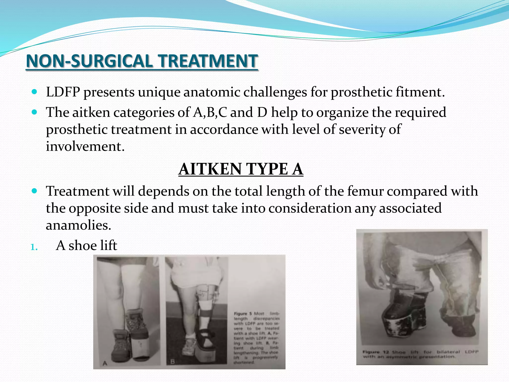 PFFD [proximal femoral focal deficiency] | PPTX