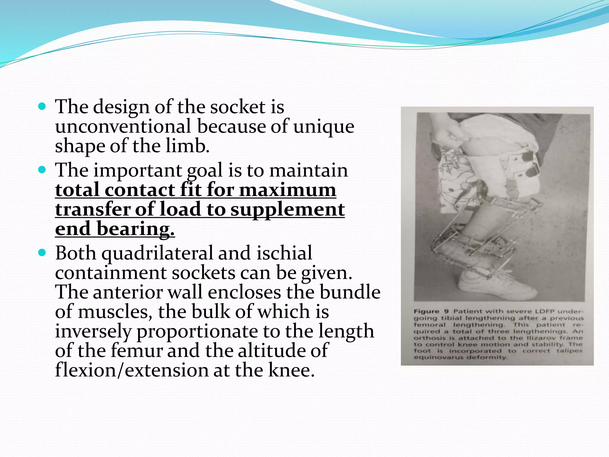 PFFD [proximal femoral focal deficiency] | PPTX