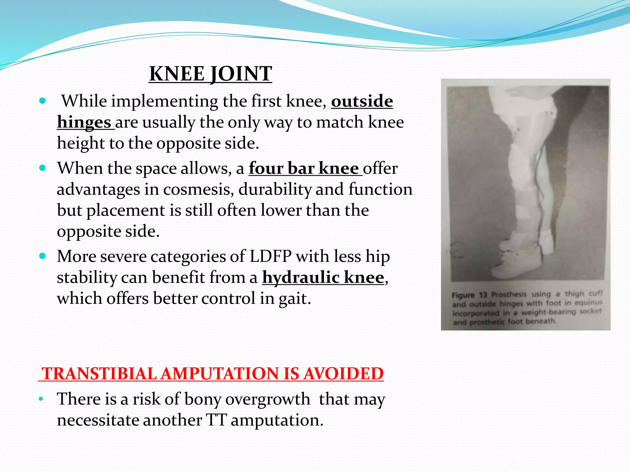 PFFD [proximal femoral focal deficiency] | PPTX