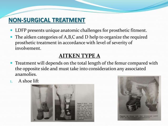 PFFD [proximal femoral focal deficiency] | PPTX