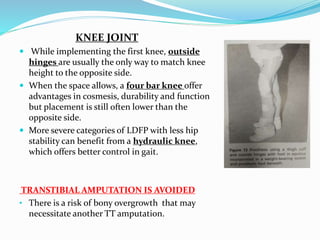 PFFD [proximal femoral focal deficiency] | PPTX