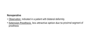 PFFD ie proximal femoral focal deficiency | PPTX