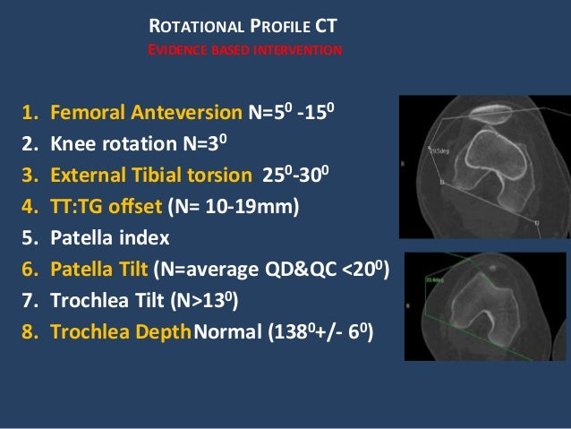 MPFL. PFJ Instability2015