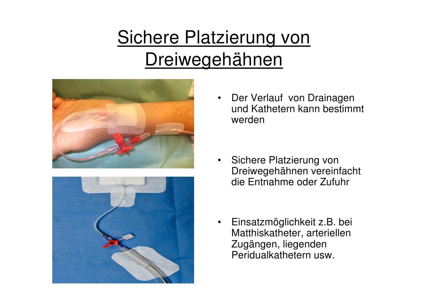 Auslassversuch Dauerkatheter – Transurethraler Dauerkatheter: Einlage ...