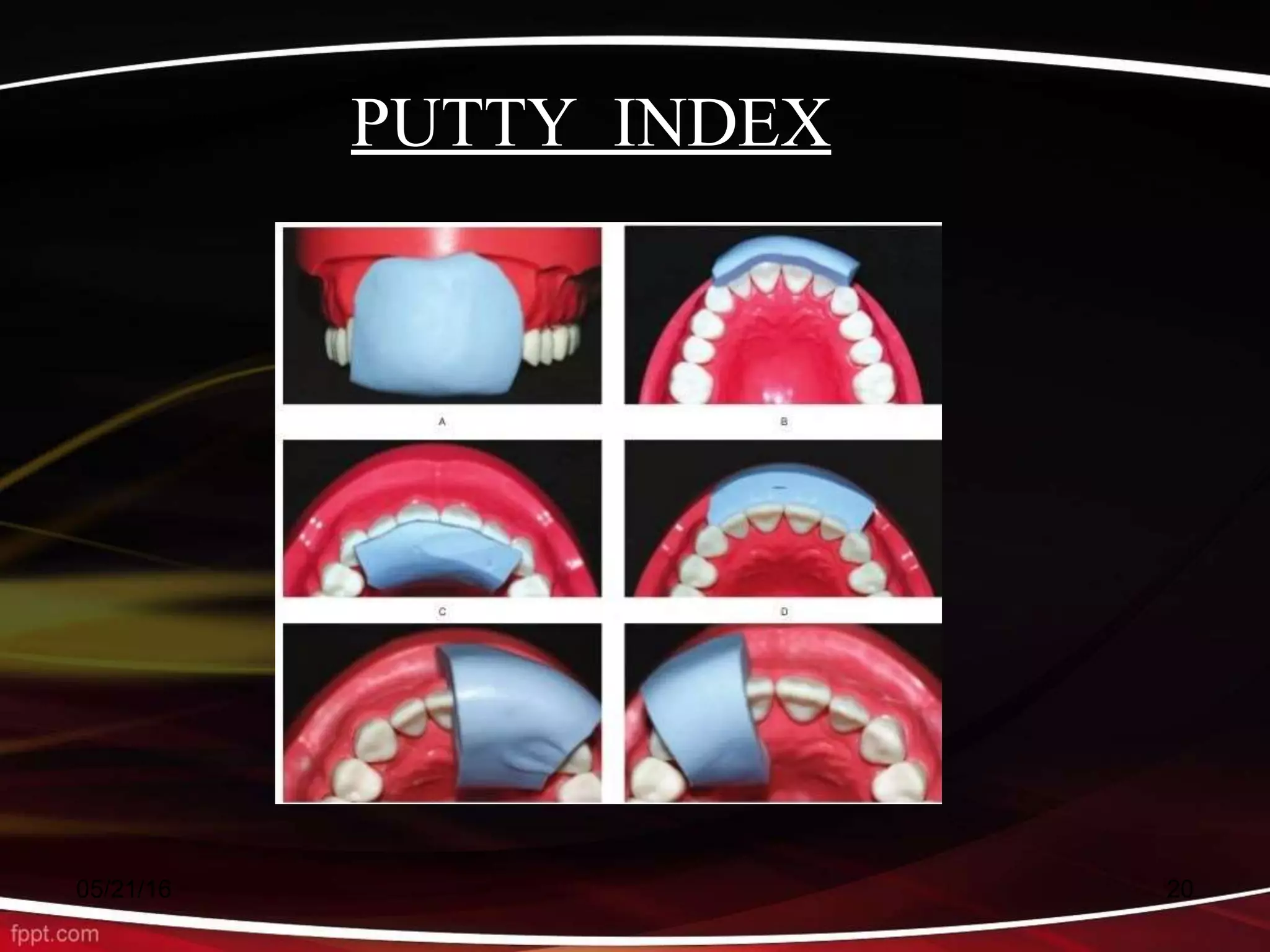 PFM PREPARATION.pptx