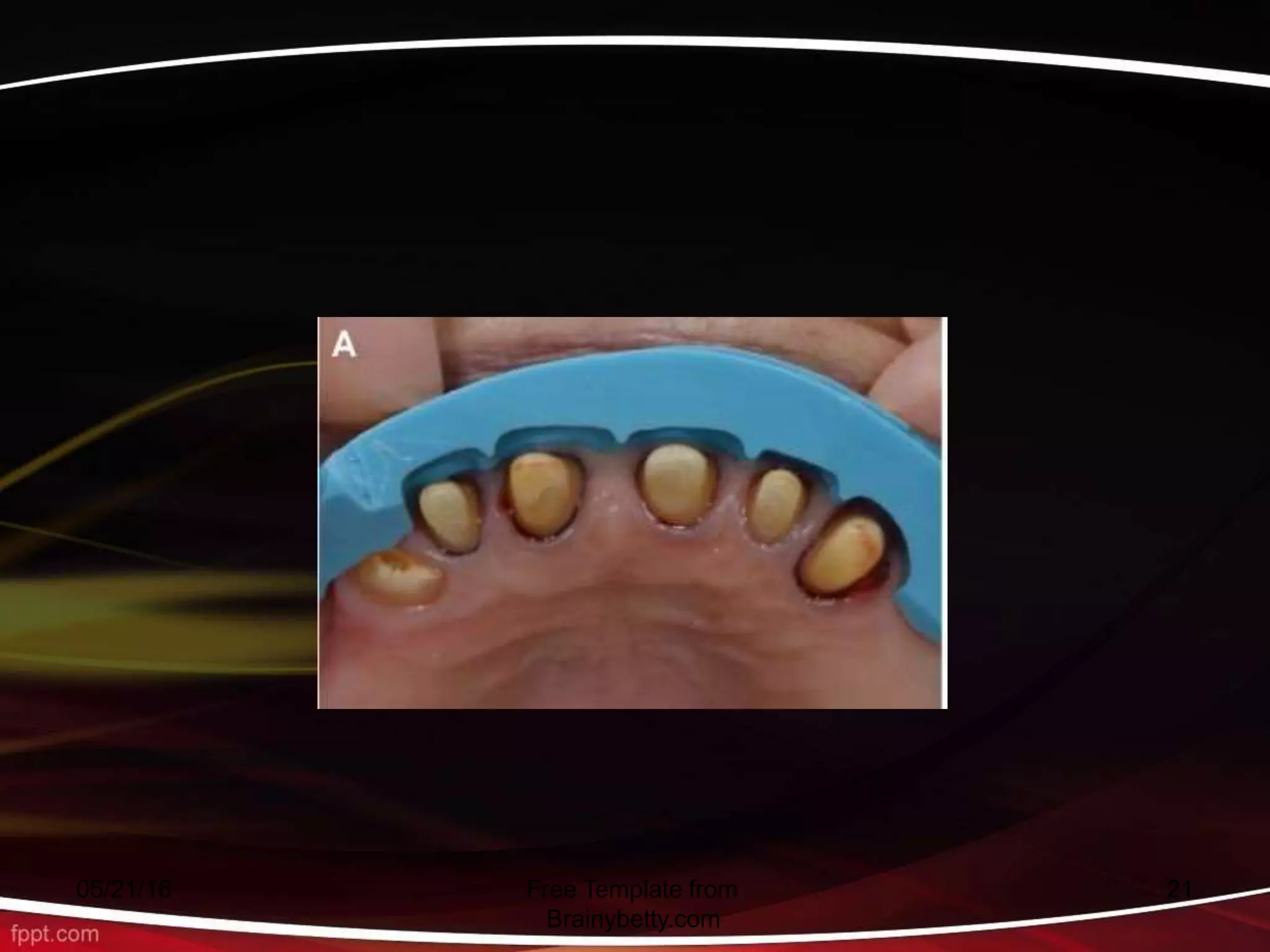 PFM PREPARATION.pptx