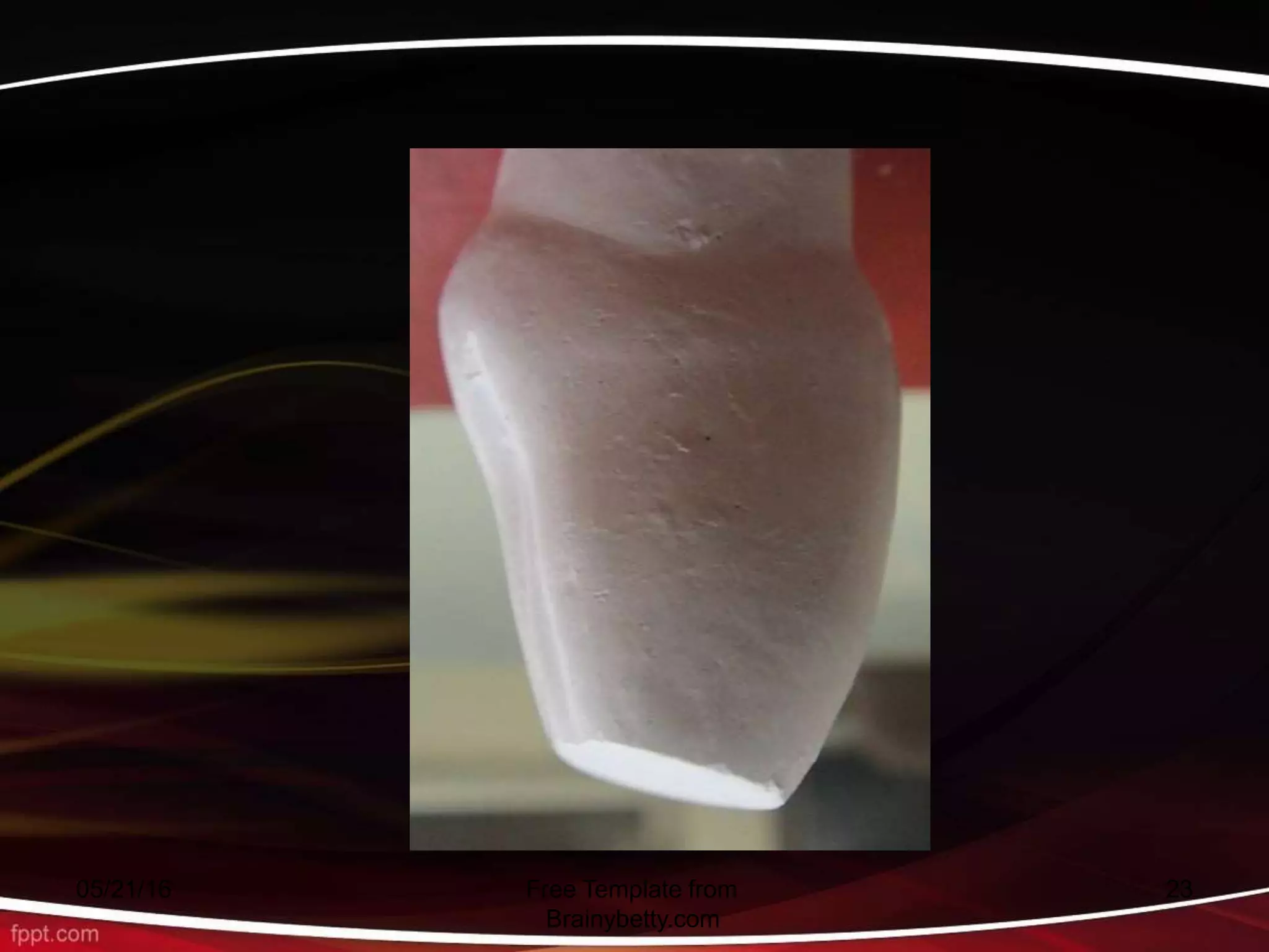 PFM PREPARATION.pptx