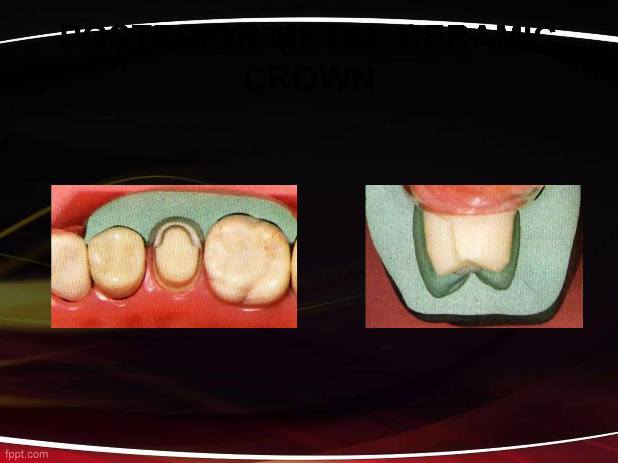 PFM PREPARATION.pptx