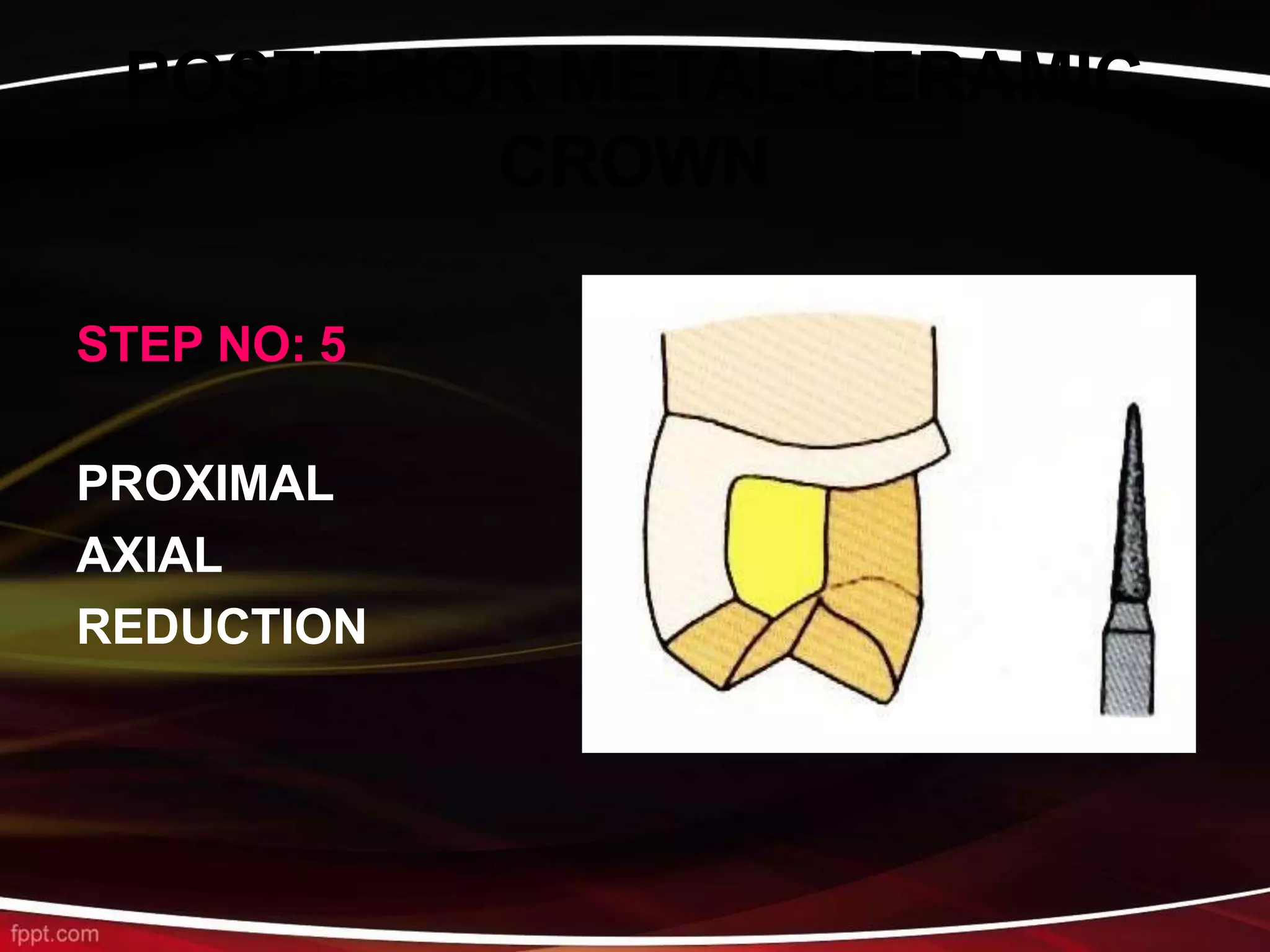 PFM PREPARATION.pptx