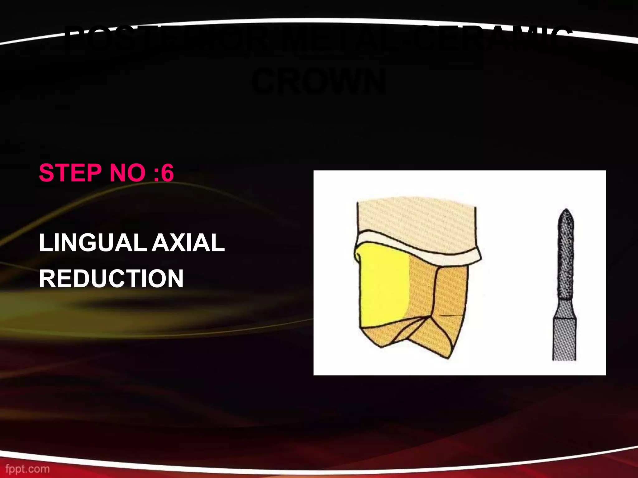 PFM PREPARATION.pptx