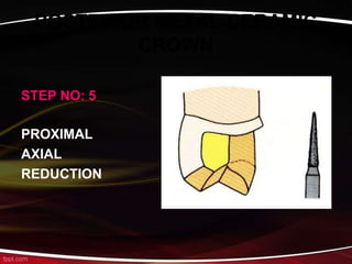 PFM PREPARATION.pptx