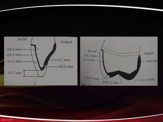 PFM PREPARATION.pptx