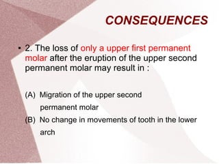 Extraction Of The First Permanent Molar | ODP