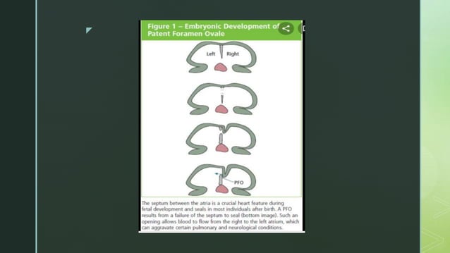 Patent foramen ovale | PPTX | Heart and Cardiovascular Diseases ...