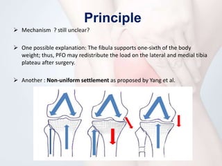 Proximal fibular osteotomy | PPTX