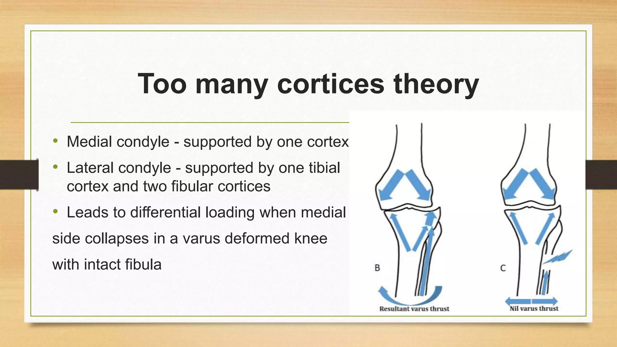 Proximal Fibular Osteotomy for Knee Osteoarthritis - What is the ...