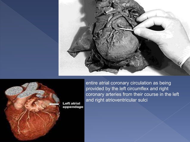 Pfo laa closure | PPTX | First Aid | Injuries