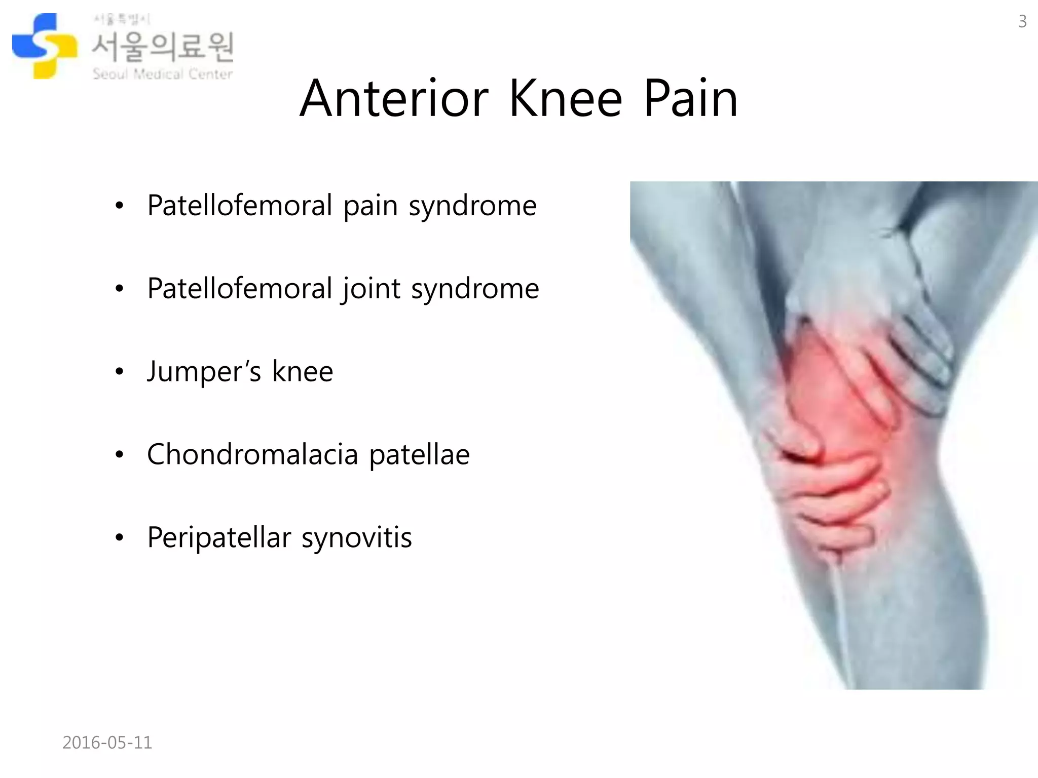 Patellofemoral Pain Syndrome | PPTX