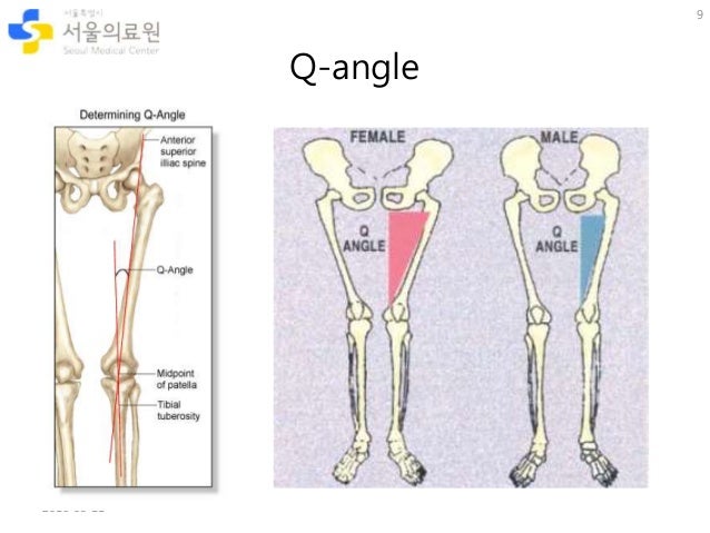 Patellofemoral Pain Syndrome