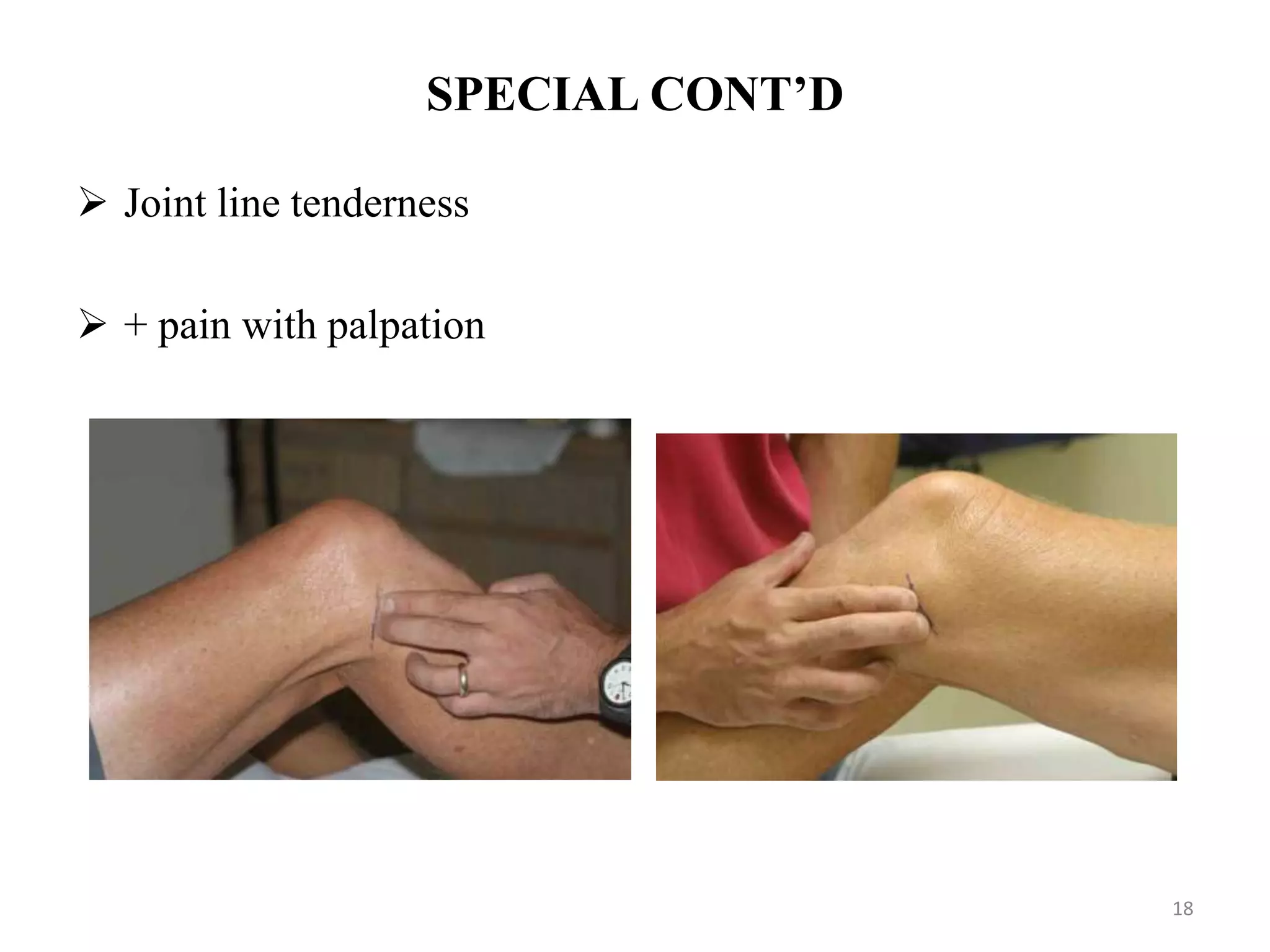 Physiotherapy management of Patellofemoral pain Syndrome | PPTX