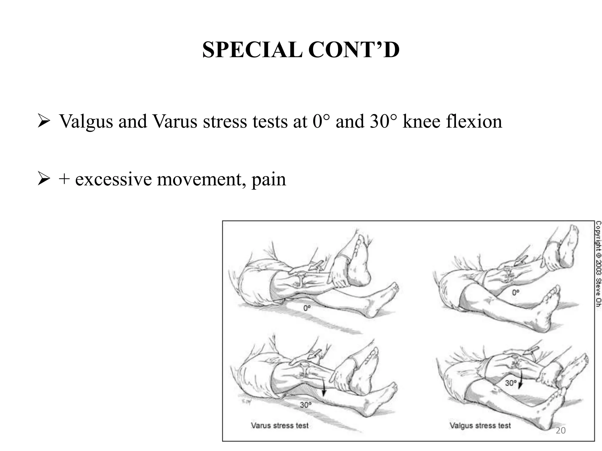 Physiotherapy management of Patellofemoral pain Syndrome | PPTX