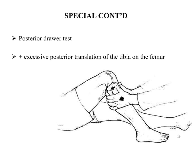 Physiotherapy management of Patellofemoral pain Syndrome | PPTX | Death ...