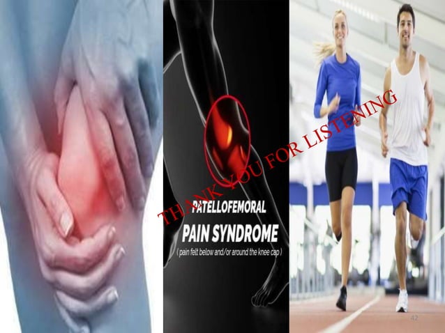 Physiotherapy management of Patellofemoral pain Syndrome | PPTX | Death ...