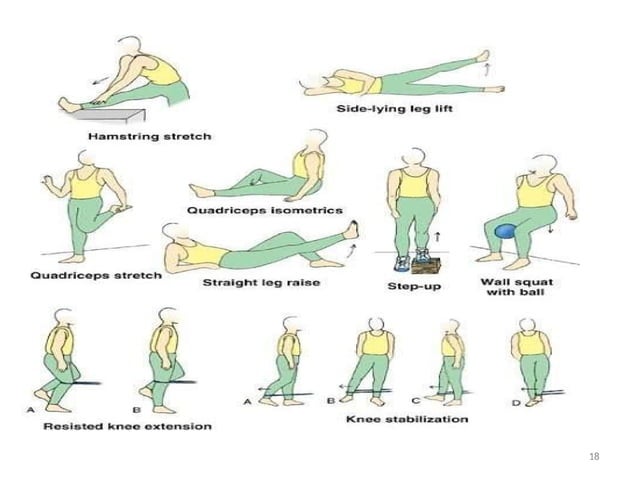 PATELLO FEMORAL PAIN SYNDROME .samarth.pptx